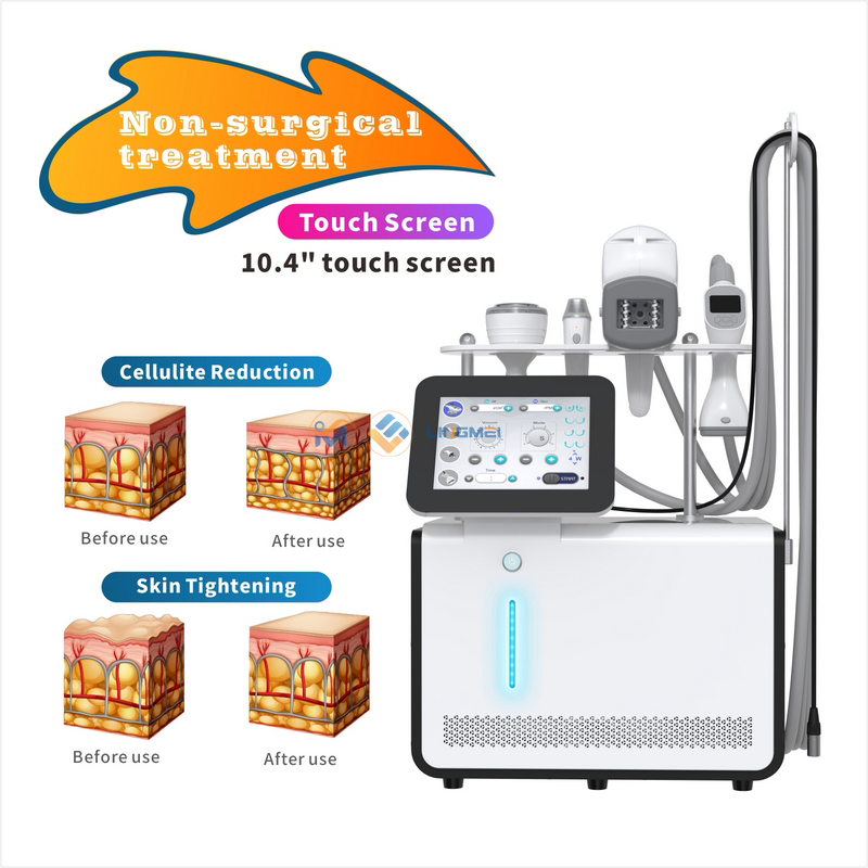 Rollsculpt Ultrasonic Cavitation Portable Velashape V9 Home Use Vacuum ...