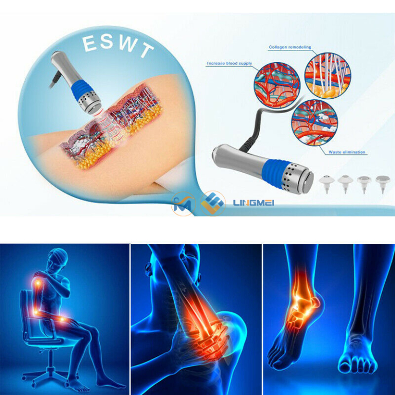 home use eswt shock wave therapy equipment electric plantar fasciitis ...