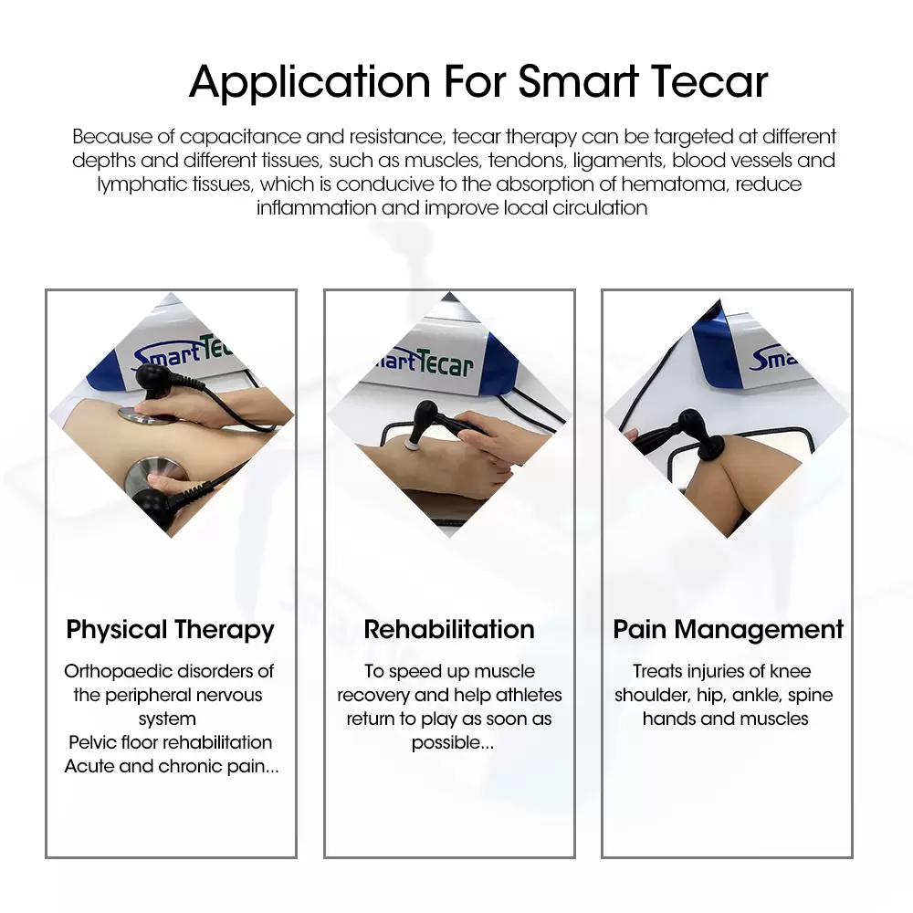 MAGIC TECAR - LINGMEI | Professional Beauty Machine Manufacturer